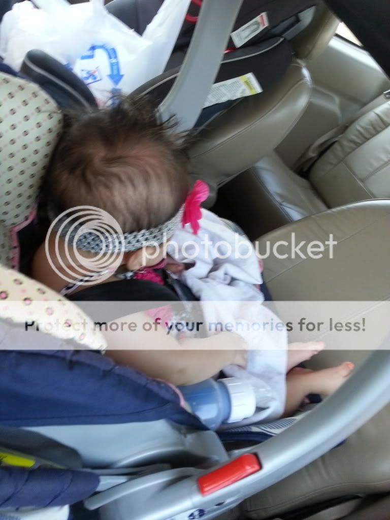 Plagiocephaly. Helmet or No Helmet? Pics included | BabyCenter